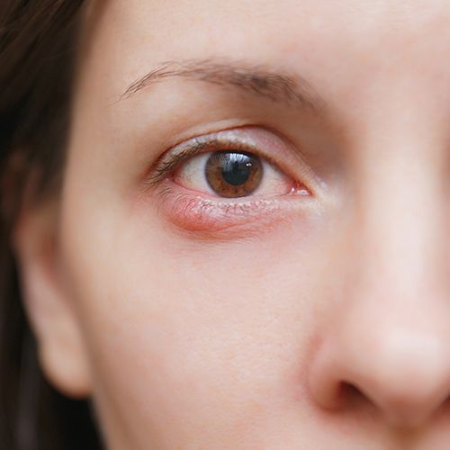 Learn about ophthalmology services at Tampa Bay Eye and Facial Aesthetics