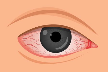 Medical Eye Exams for West Pasco Eye Care