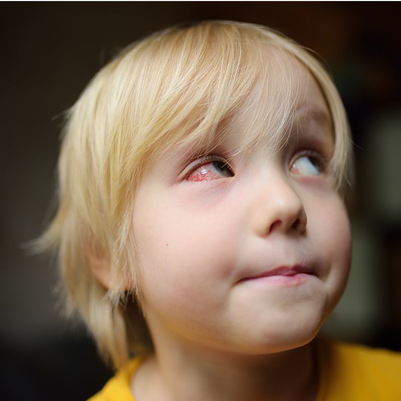 Optometrist in Houston | Heights Vision Specialists