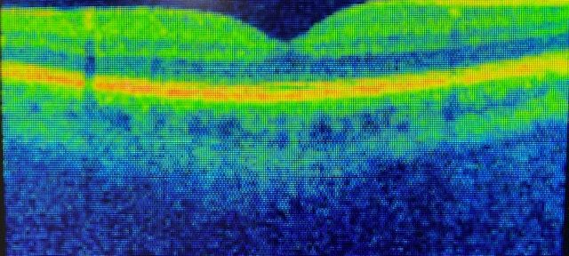 Eye Care Technology | Eye Doctors in Great Barrington, MA