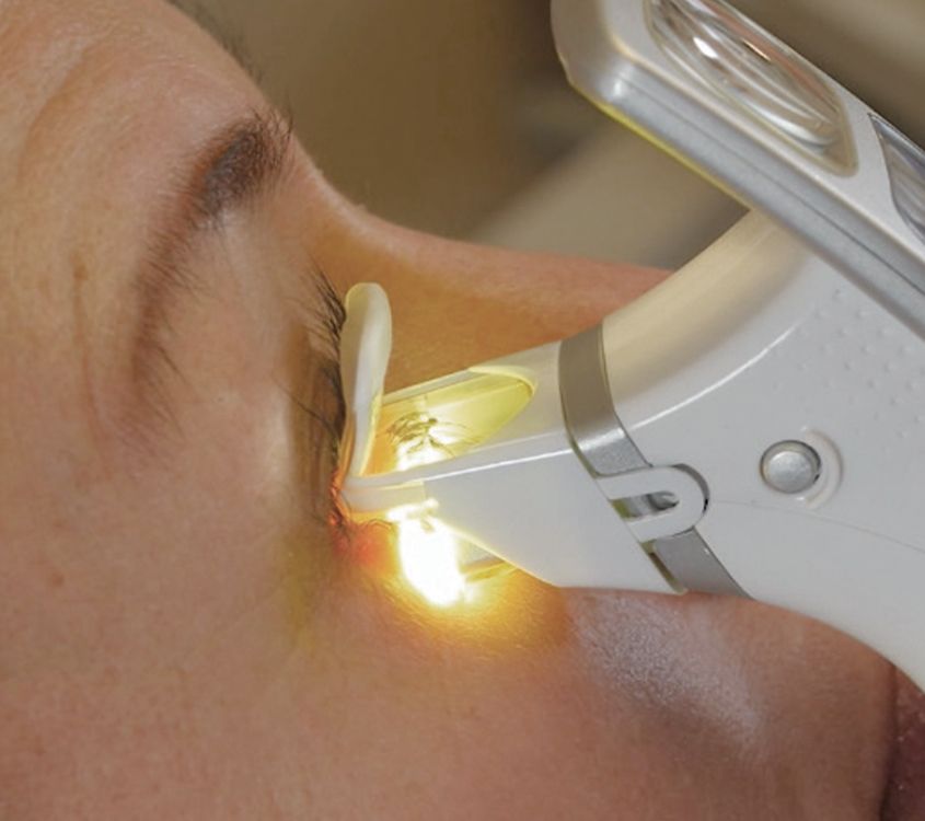 iLux Treatment
