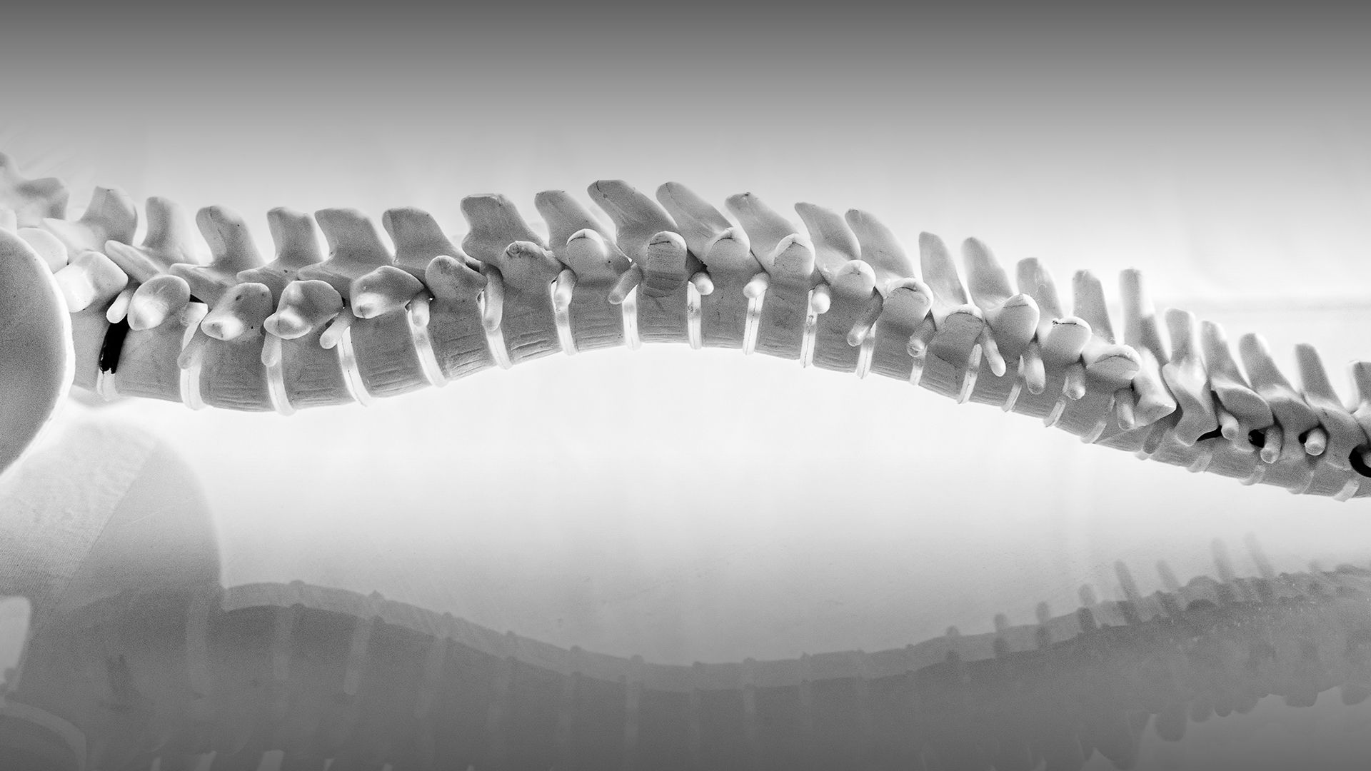 Chiropractic in Brooklyn | Compassion Chiropractic