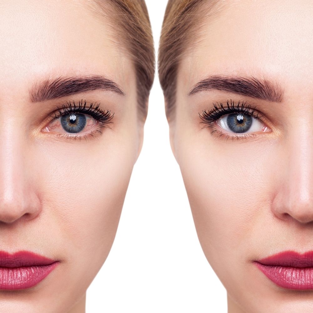 Blog - Los Angeles Eye Doctors | Optikos Optometry | Page 1