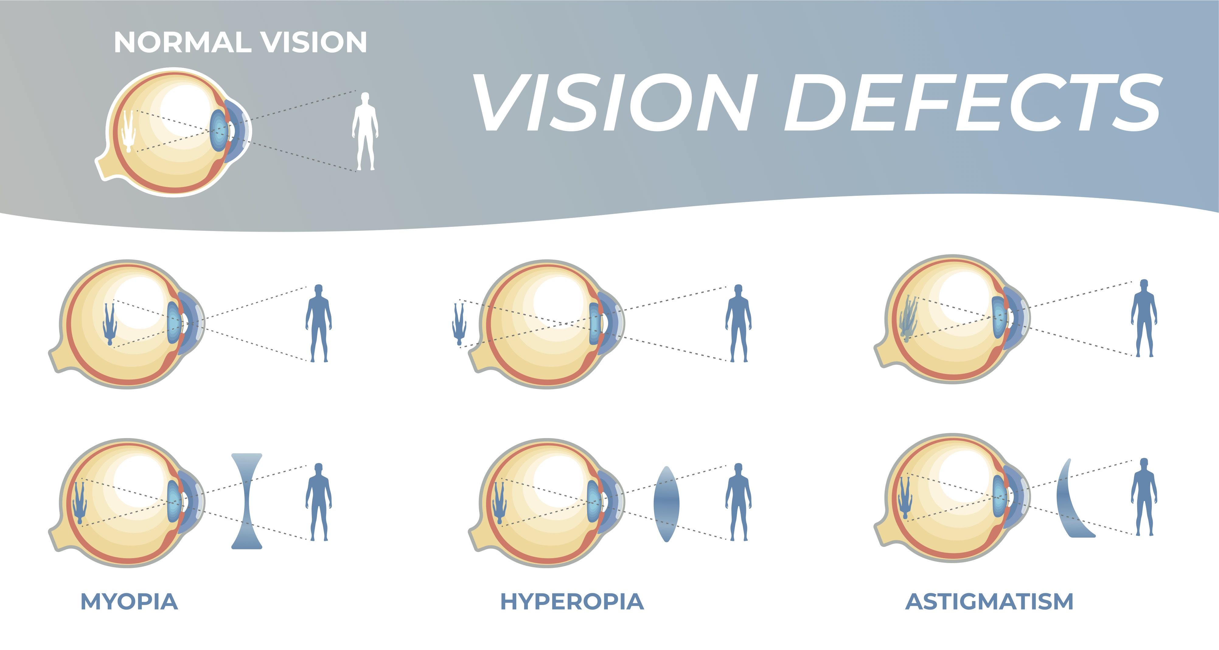 Vision Health | Everything You Need to Know | Eye Doctor