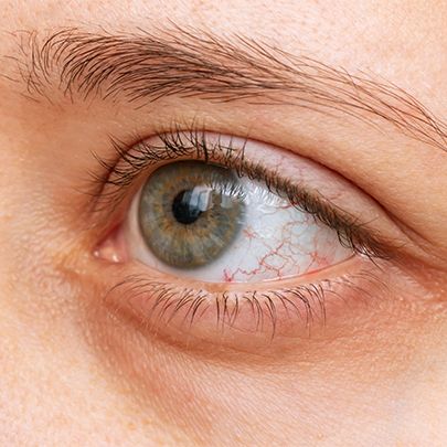 Optometrist in Maple Grove | Maple Grove Eye Care