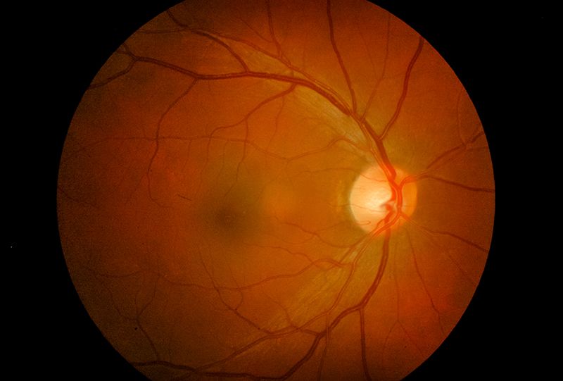 Eye Doctors | Inland Empire | Riverside