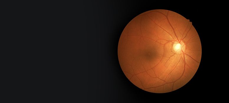 Optometrist in Grayson | Grayson Optical