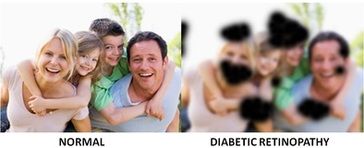 Diabetic Retinopathy | EyeRis Vision - optometrist in Austin, TX