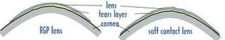 Contact Lenses| EyeRis Vision - optometrist in Austin, TX