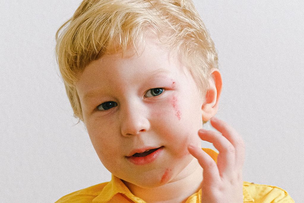 Urgent Eye care at Swoop Eye Care