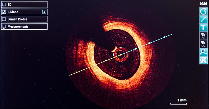 Eye Doctors in San Antonio, TX | Bluebonnet Eye Care