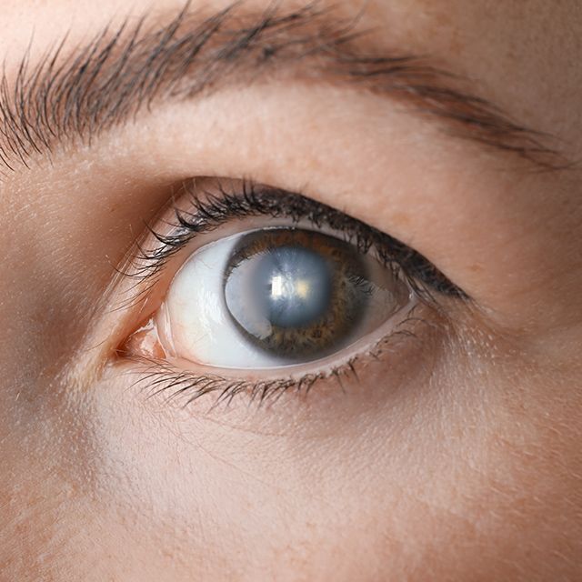 Optometrist in Monroe | Monroe Vision Clinic