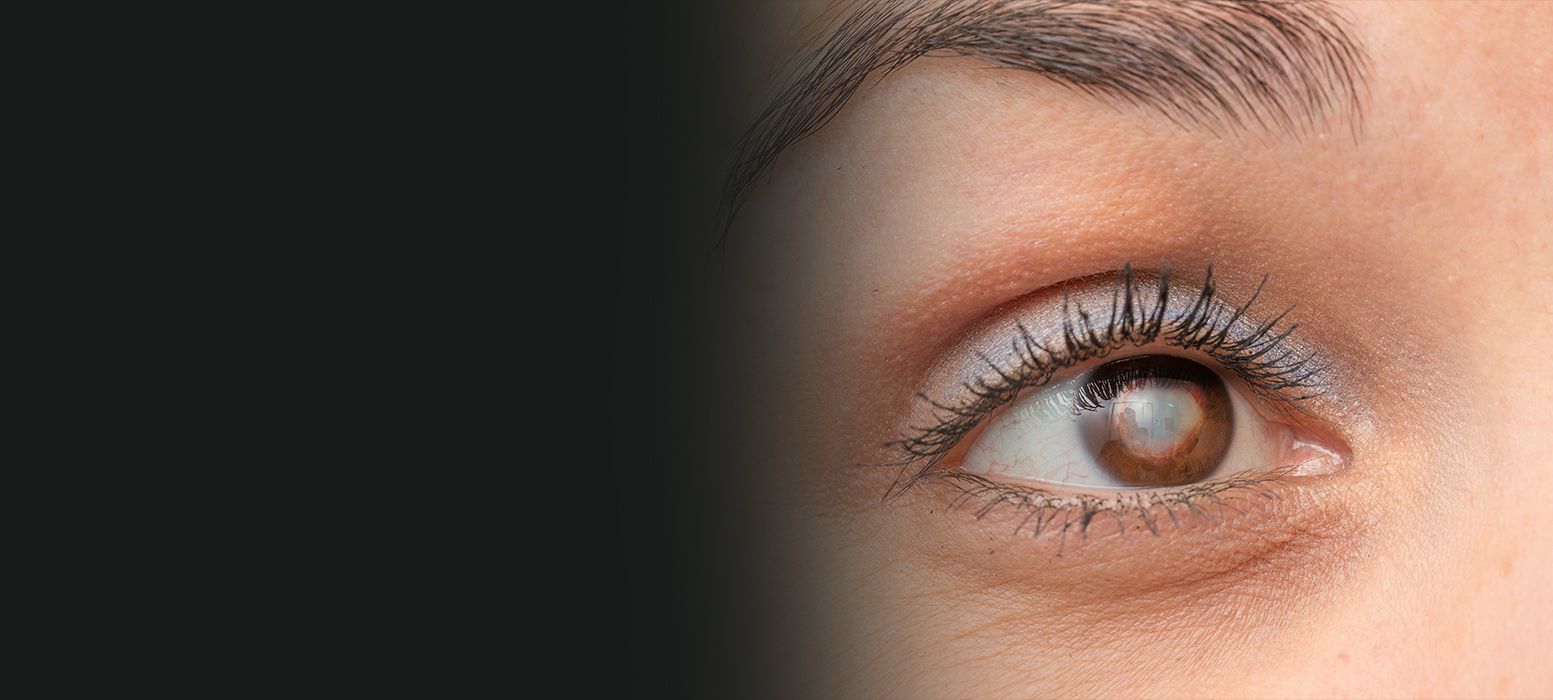 Optometrist in Greenville | Martin Eye Care