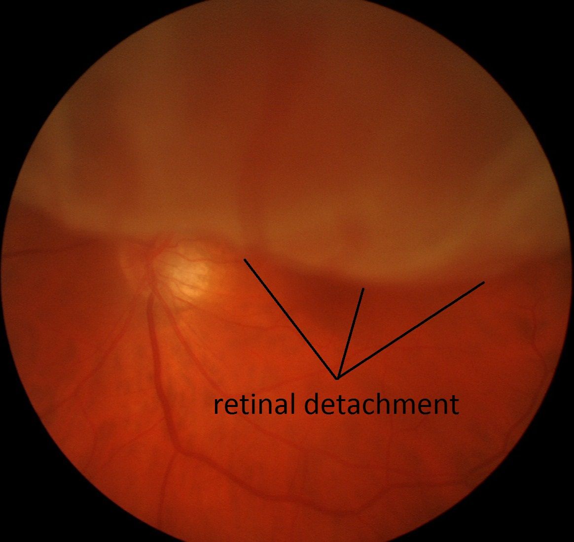 Eye Condition Diagnosis | Eye Doctors in Elmhurst, IL