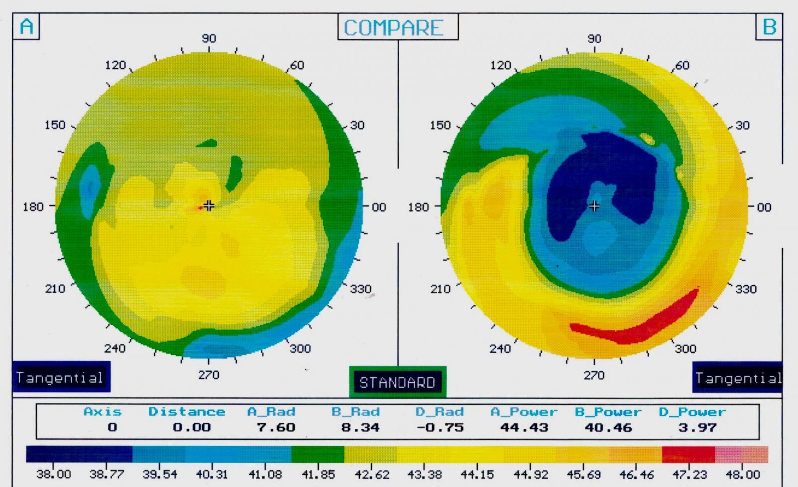 Disposable Soft Contact Lenses in Elmhurst, IL | Skowron Eye Care
