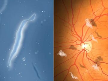 Eye Doctors in Richmond - Midlothian VA | Grove Eye Care