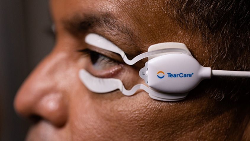 Dry Eye Treatment in Exeter, NH | Mayo Family Eye Care, LLC