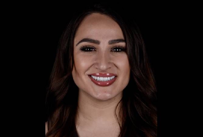 Smile Inquiry