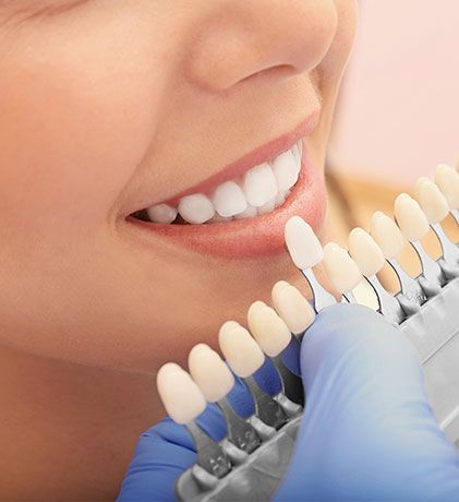 Tooth-Colored Fillings