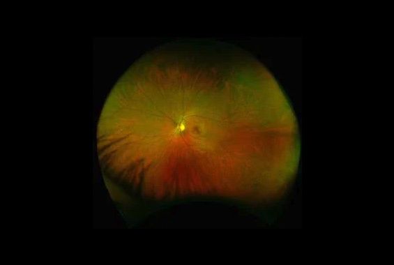 Advanced Eye Care Technology | Cecilia Perez, OD, Los Angeles