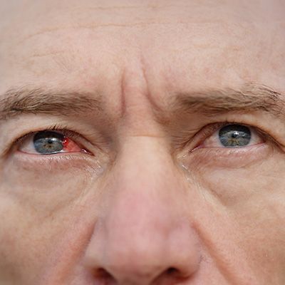 Optometrist in Highland | Eyecare Connection